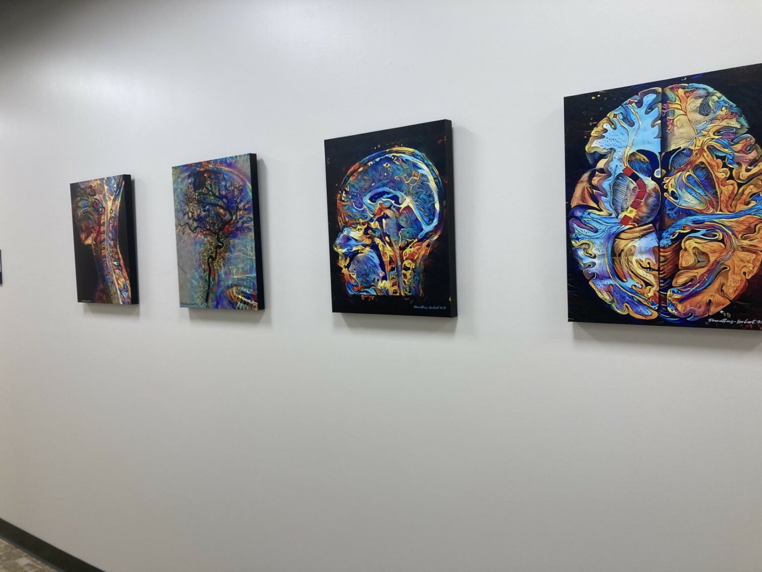 New Rockefeller Neuroscience Institute Clinic opens in Spring Mills ...